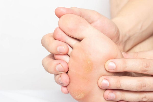Callosidades en los pies: prevenirlas y quitarlas | CeraVe