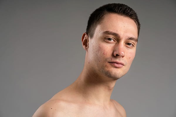 Cómo tratar las espinillas en la nariz: consejos y productos | CeraVe